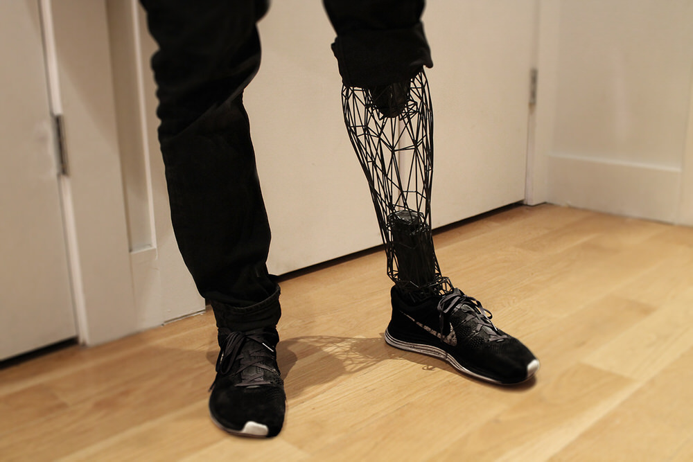 EXO 3D Printed Prosthetic Limbs By William Root Homeli